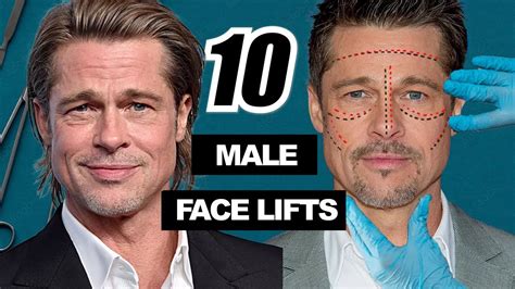 Celebrity Face Lifts 60 Photos Moonagedaydreamfilm