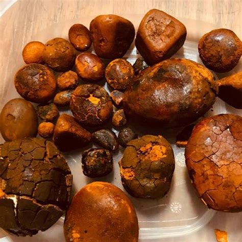 Premium Cattle Gallstones