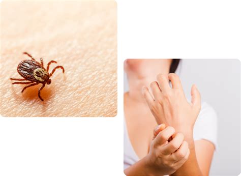 Apa Itu Tungau Dekleen