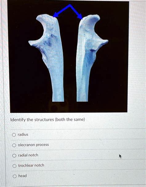 Solved 16 Identify The Structures Both The Same Radius Olecranon Process Radial Notch