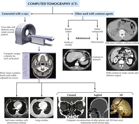 Window Leveling Definition Radiology At Alan Koester Blog