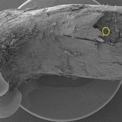 Sem Image Of Bone Area At Proposed Implant Site Spherical Discharges