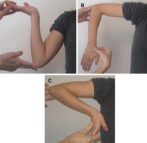 Ulnar Tunnel Syndrome Test Ulnar Nerve Entrapment Fmadrg