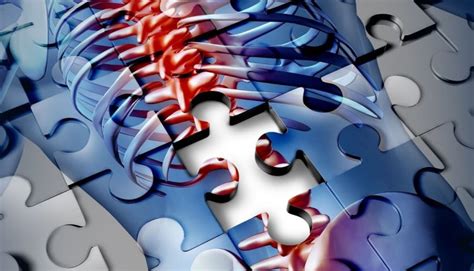 Dextrocardia Dexiocardia Mirror Heart Dextroversion And Dextroposition