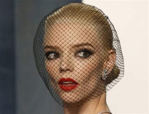 Anya Taylor Joy Before And After Plastic Surgery