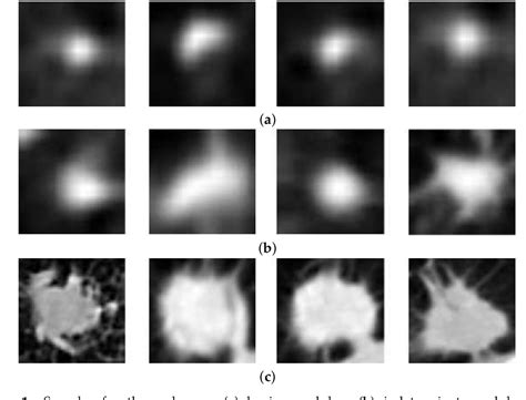 Figure 1 From Multi Level Cross Residual Network For Lung Nodule Classification Semantic Scholar