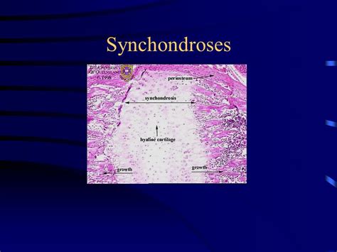The Skeletal System Bone Provides Rigid Support For The Soft Tissues Of