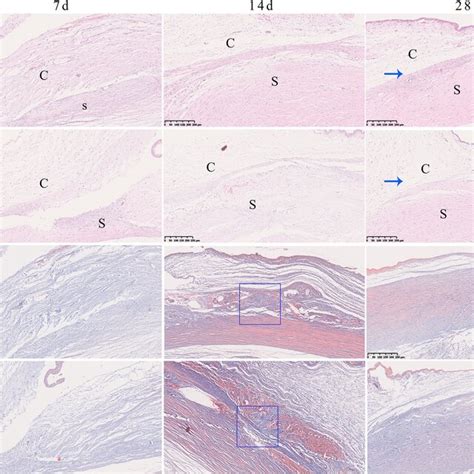Scleral Cxl During Surgery And Kinetics Of The Function Of Filtering