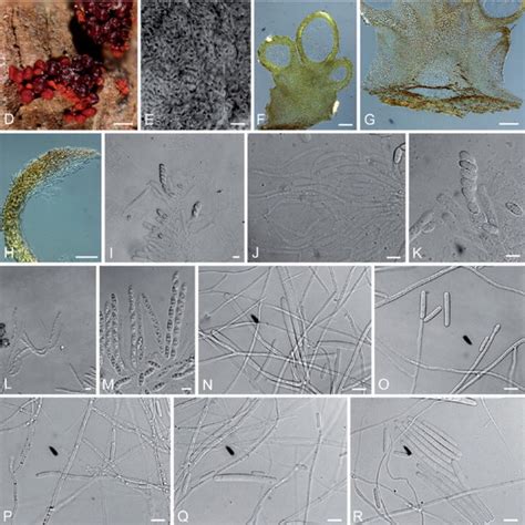 Pdf Delimitation Of Neonectria And Cylindrocarpon Nectriaceae Hypocreales Ascomycota And