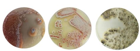 Streptomyces Sp Strain Dsd011 Dsd017 And Dsd042 Left To Right