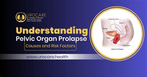 Empower Yourself Understanding Causes Of Pelvic Organ Prolapse