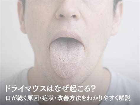ドライマウス口腔乾燥症はなぜ起こる？口が乾く原因・症状・改善方法をわかりやすく解説 Lion歯科・矯正歯科