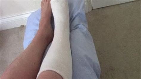 Freshly Plastered Leg Cast Toe Close Ups Casted Catie Clips4sale