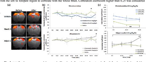 Figure 1 From Adrenergic Receptor Agonist Vs Antagonist Tuning
