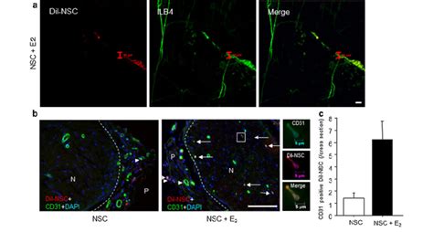 Nsc Differentiation To Ec In Vivo A Whole Mount Staining Of Sciatic Download Scientific