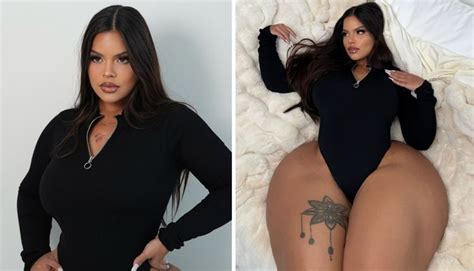 Gracie Bon Revela Sufre De Lipedemia En Las Piernas ¿qué Es