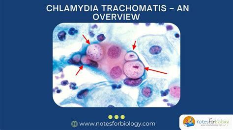 Chlamydia Trachomatis An Overview Best Biology Notes