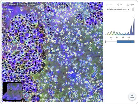 Bioturing Lens Spatial Omics Analytics Platform