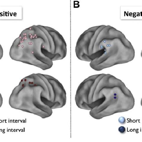 Posterior Parietal Anatomy Lateral Posterior Parietal Cortex Ppc Is
