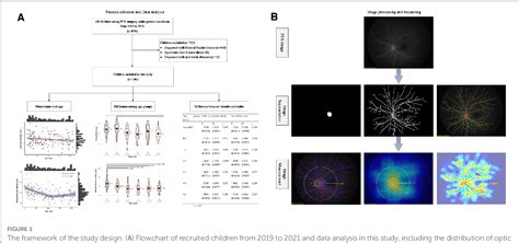 Figure 1 From Optic Disc And Retinal Vascular Features In First 6 Years