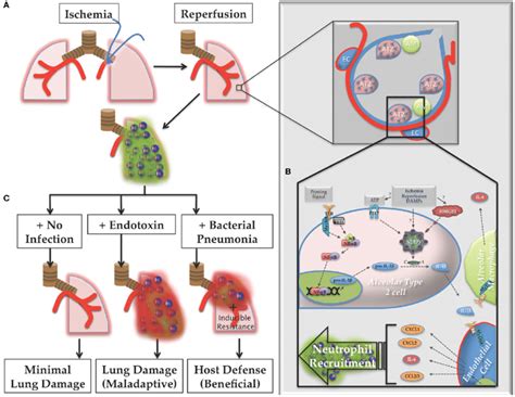 Proposed Model Of Lung Ischemia Reperfusion Ir Biology A Download Scientific Diagram