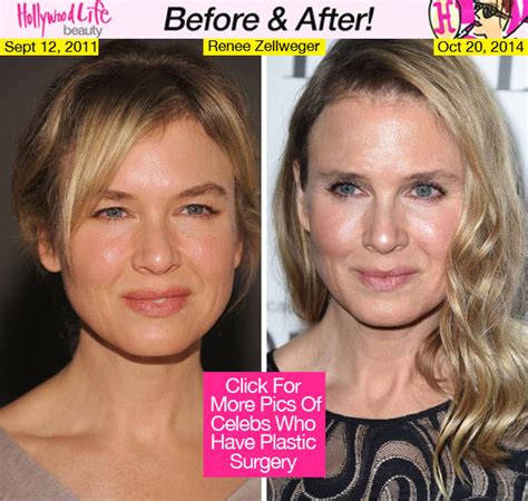Renee Zellweger Before And After Celebrity Review Renee Zellweger