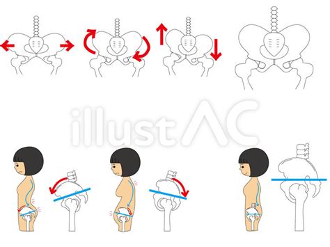 Free Vectors Illustration Set For Pelvic Correction