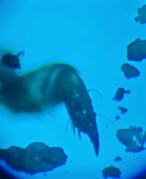 Mealworm This Is Under A Microscope Cant See With Naked Eye Though So Not Sure R Mealworms