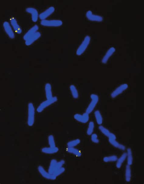 Chromosomal Mapping Of Mouse Mcol A Fluorescent In Situ Hybridization