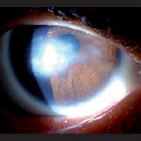 Central Epithelial Defect Download Scientific Diagram