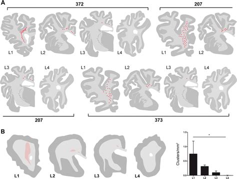 Topographical Distribution And Amount Of The Dcx Cell Clusters In The Download Scientific