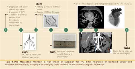 Migration Of Fragments Of Inferior Vena Cava Filter To Heart And Lung
