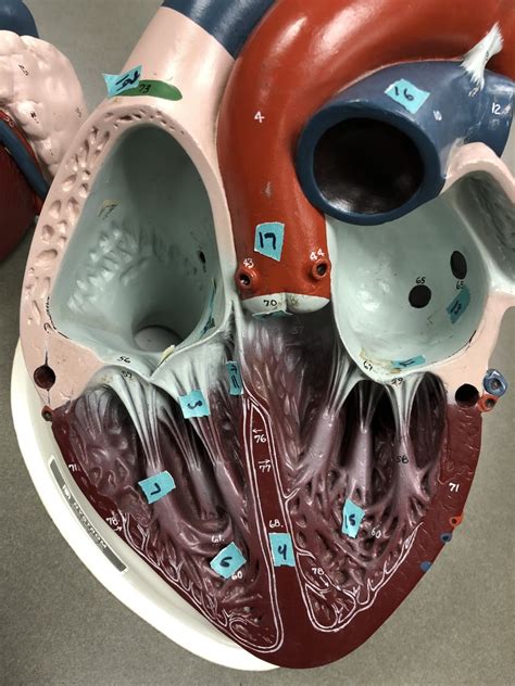 Heart Pt Vi Diagram Quizlet