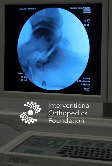 Chris Centeno Md Posted On Linkedin