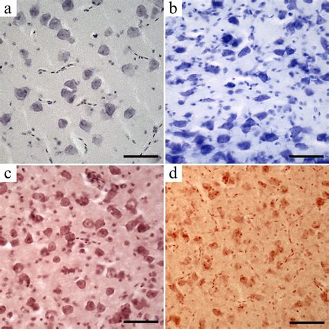 14 Microphotographs Of The Telencephalic Regions With No Cell Clusters Download Scientific