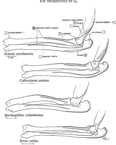 Extensor Surface Of The Forearm Radius Ulna And Distal
