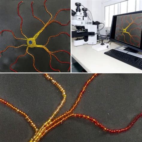 Beaded Neuron Under A Microscope In The Lab Things Under A Microscope