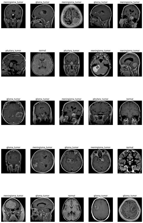 Github Mojtabazarrehbrain Tumors Classification Brain Image