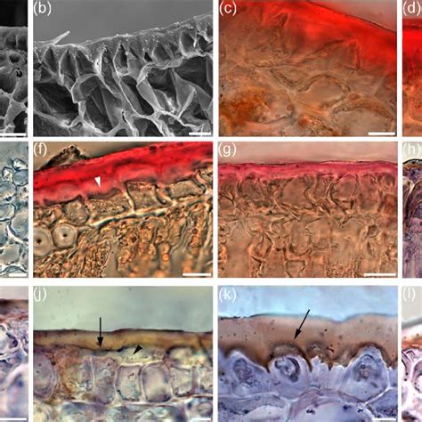 Cutinization In The Outer Cell Wall Of Epicarp Ae And Adaxial Leaf