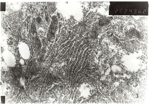 Secretory Cell M Mitochondria Rer Rough Endoplasmic Reticulum