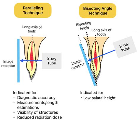 Paralleling Định Nghĩa Cách Sử Dụng Và Ví Dụ Minh Họa
