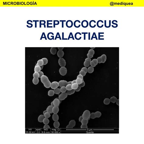 Streptococcus Agalactiae Diego De La Hoz