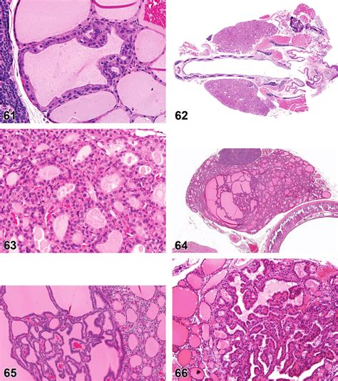 Mouse Thyroid Gland Hyperplasia Follicular Cell Focal With Piling Up Download Scientific