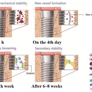 The Process Of Osseointegration Over Time [18] Reprinted With