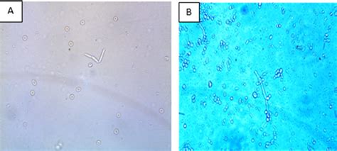 Extracellular Hydrolytic Enzyme Production By Dcapitatus A