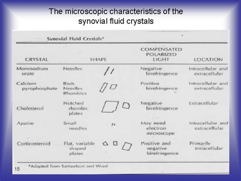 Urinalysis And Body Fluids Synovial Fluid Lecture Two