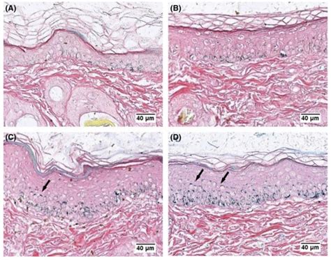 《文献解读》为什么说，皮肤屏障受损是黄褐斑发病的重要病因？ Medscicn