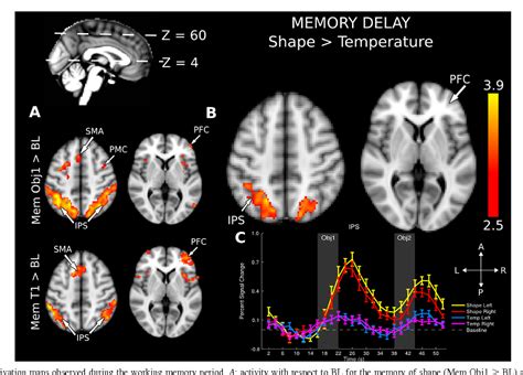 Figure 3 From The Parietal Cortices Participate In Encoding Short Term