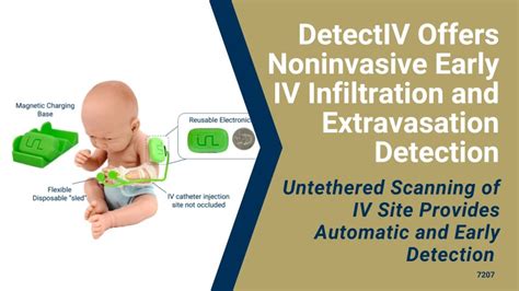 Michael Varon On Linkedin Detectiv Offers Noninvasive Early Iv