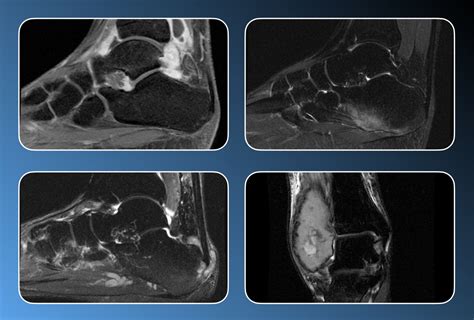 Imaging Of Viral Pneumonia And Its Differentials Berlincaseviewer Von Berlinflame Gmbh